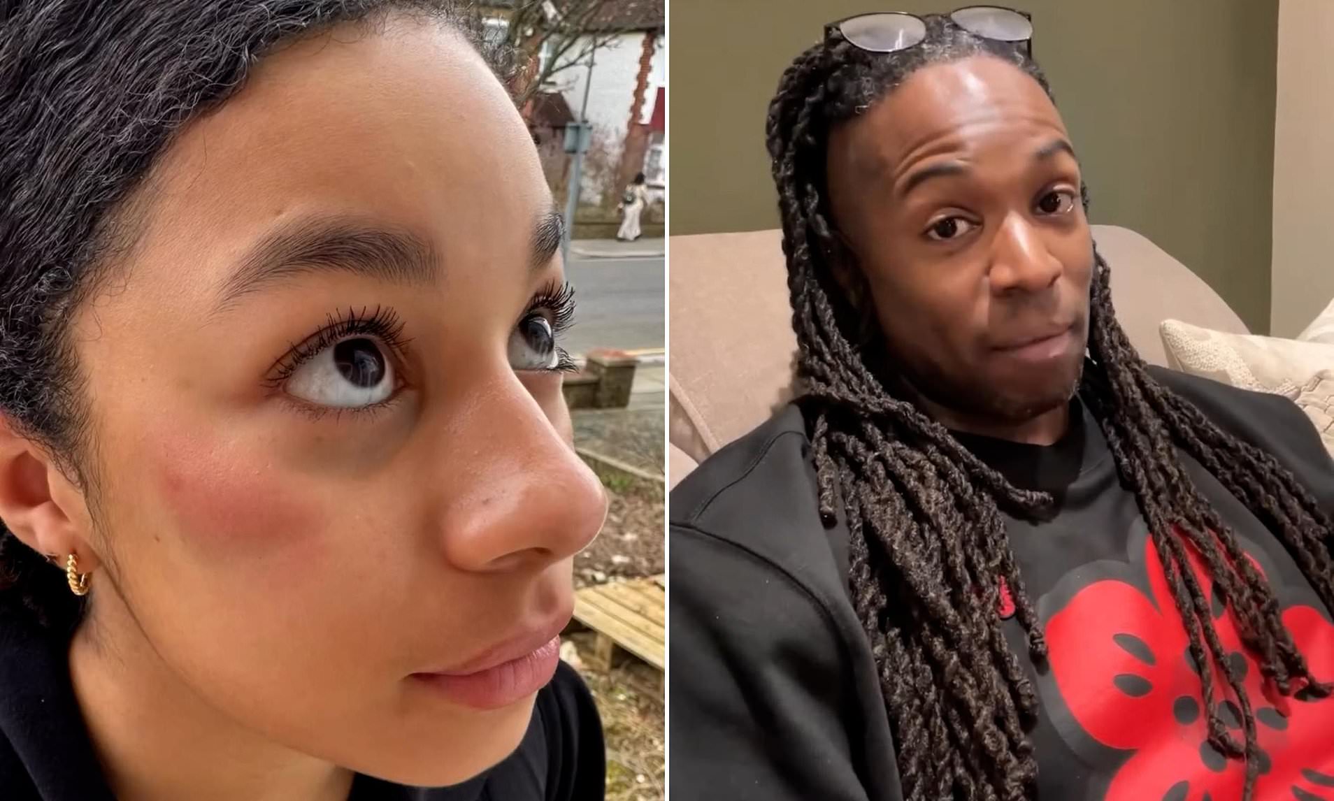 CBeebies host says daughter, 16, has been left with black eye after ...