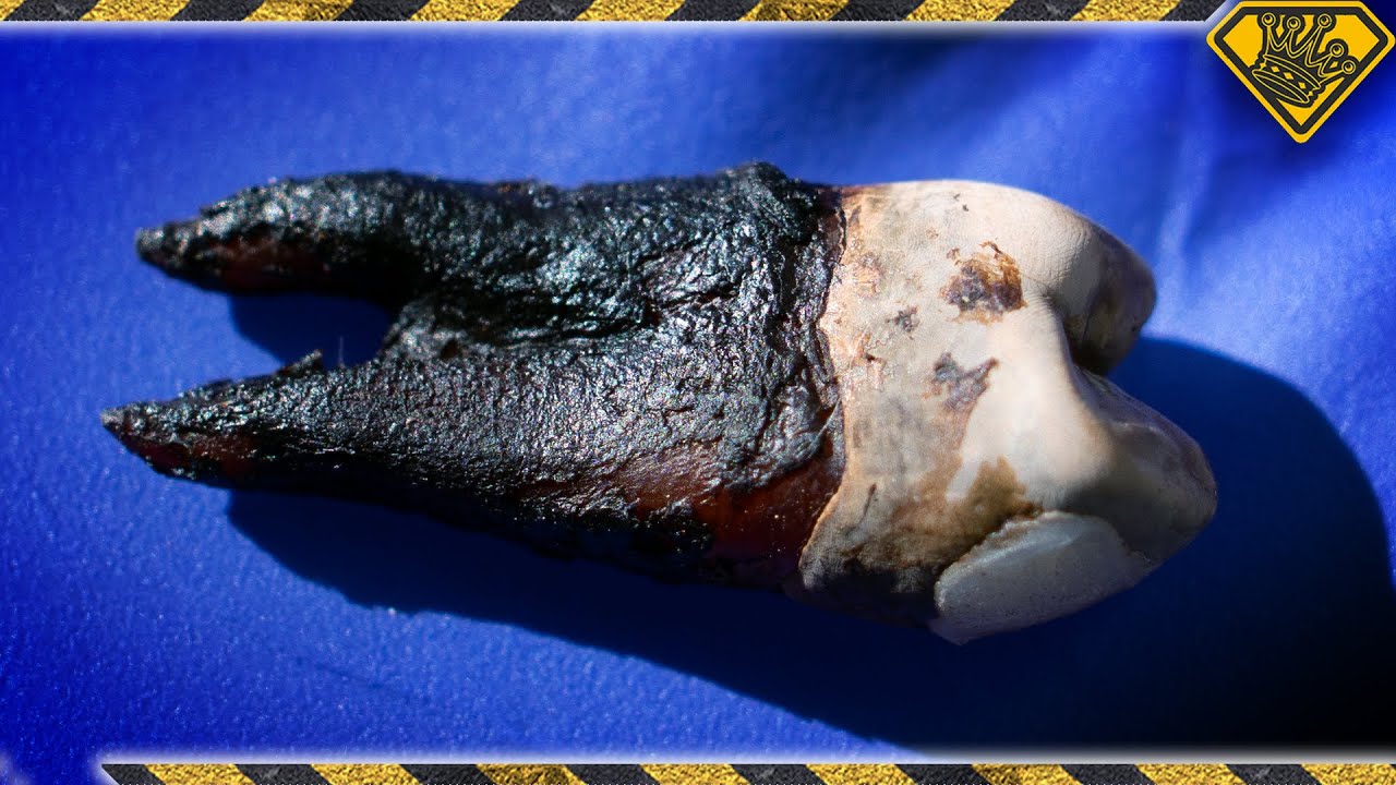 What really happens to your teeth when you drink Coke