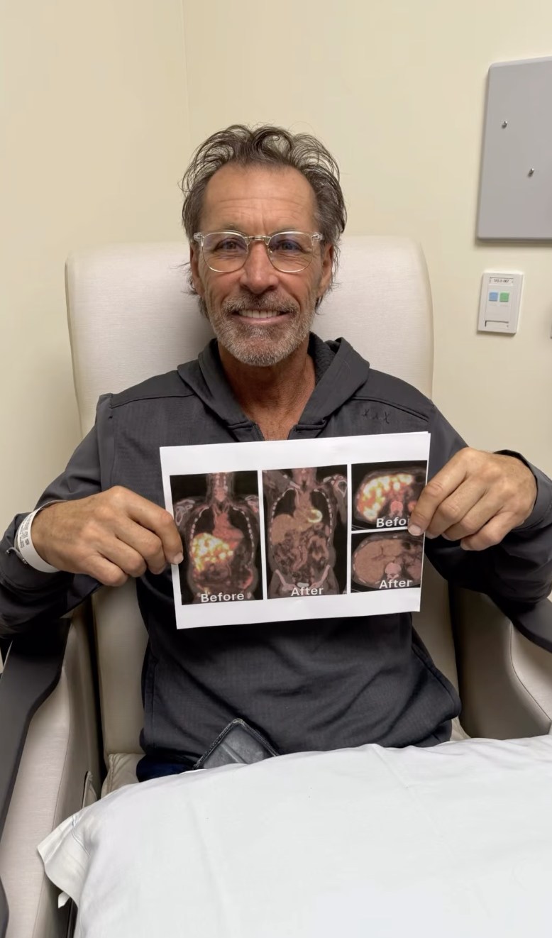 Ron Duguay details great lengths he’s going to in cancer fight — and ...