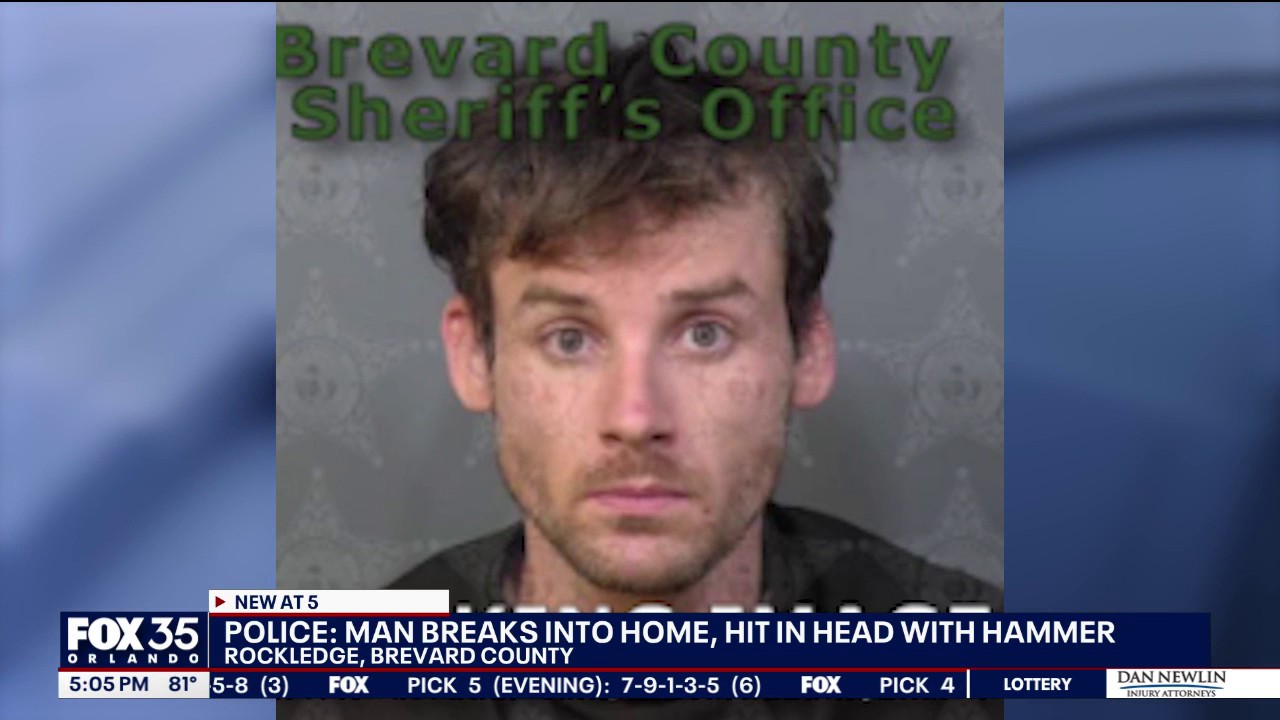 Police: Man hit with hammer after breaking into home