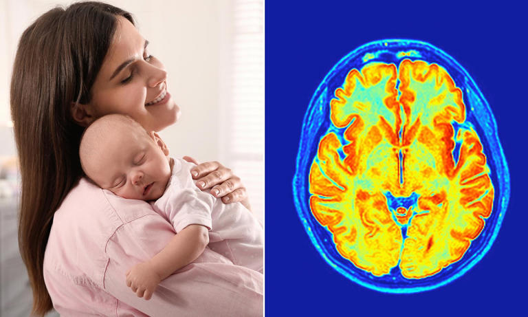 'Baby brain' is no joke - it does exist, study finds