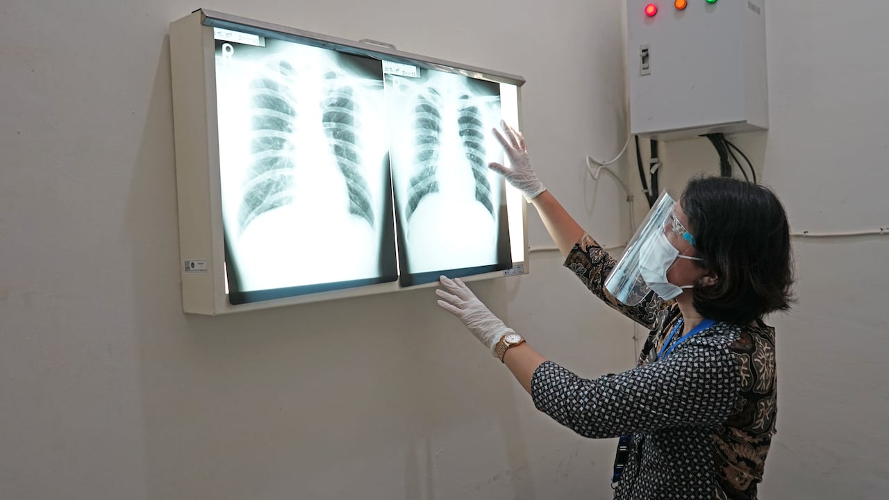 Tuberculosis outbreak in Natuashish, say NLHS, Mushuau Innu First Nation