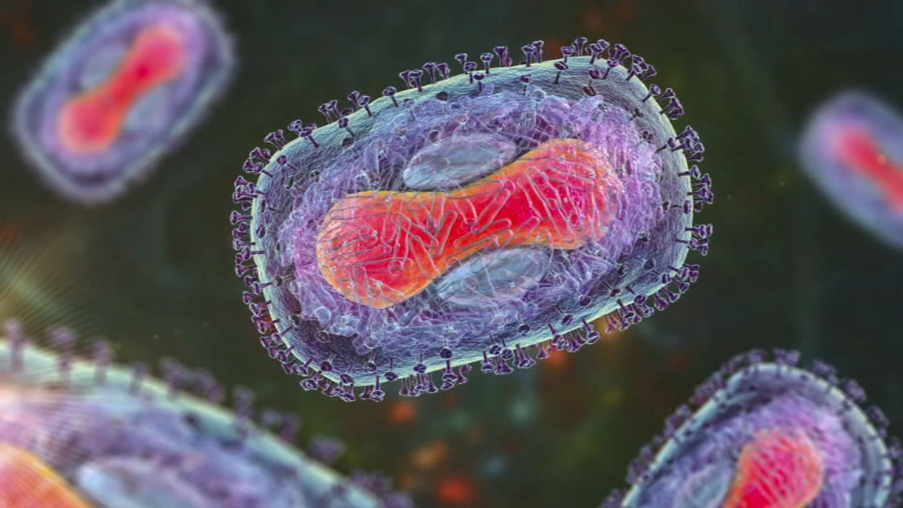 First known case of severe mpox strain discovered in NYC