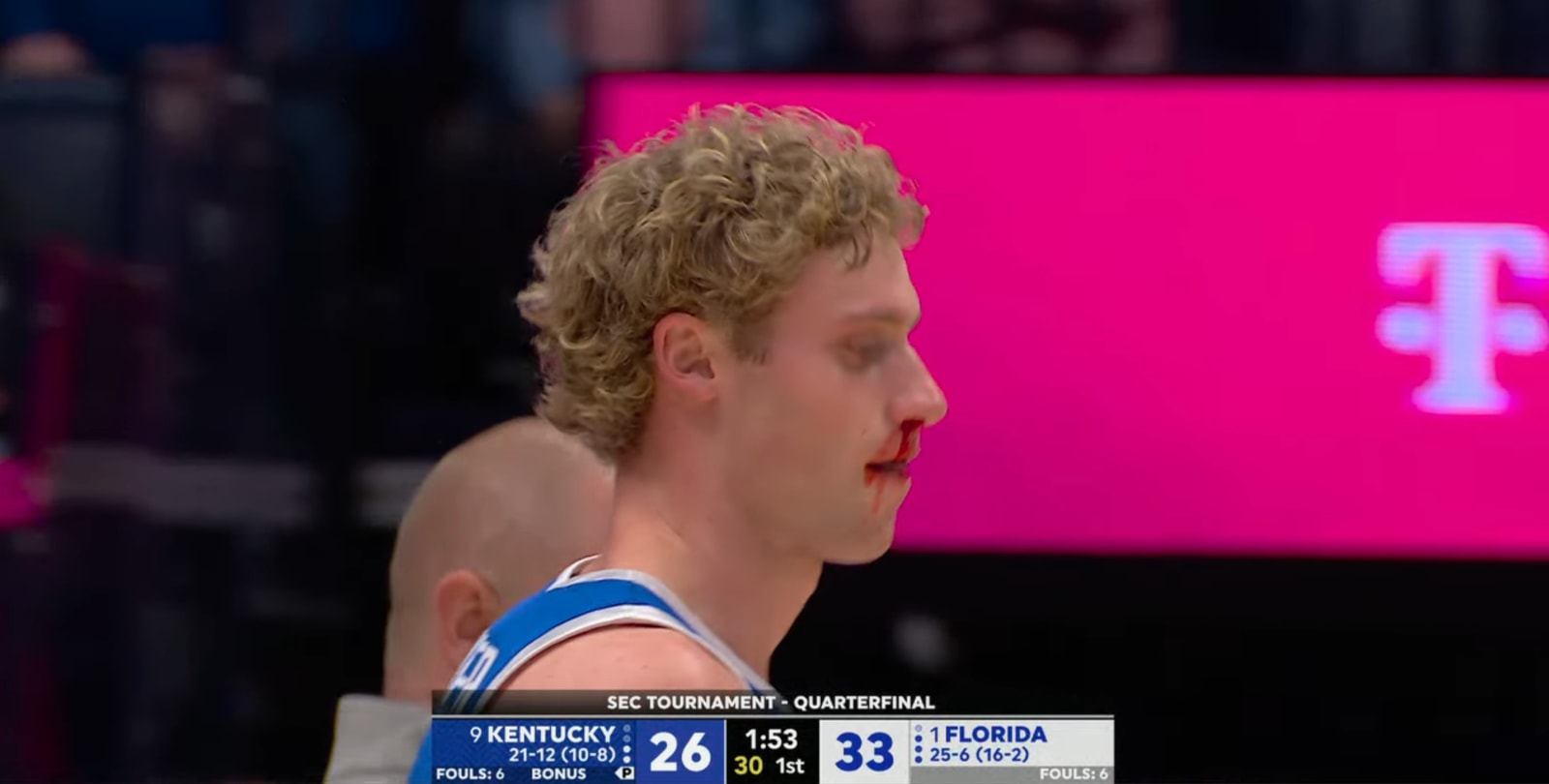 Collin Chandler should wear a helmet in the SEC tournament