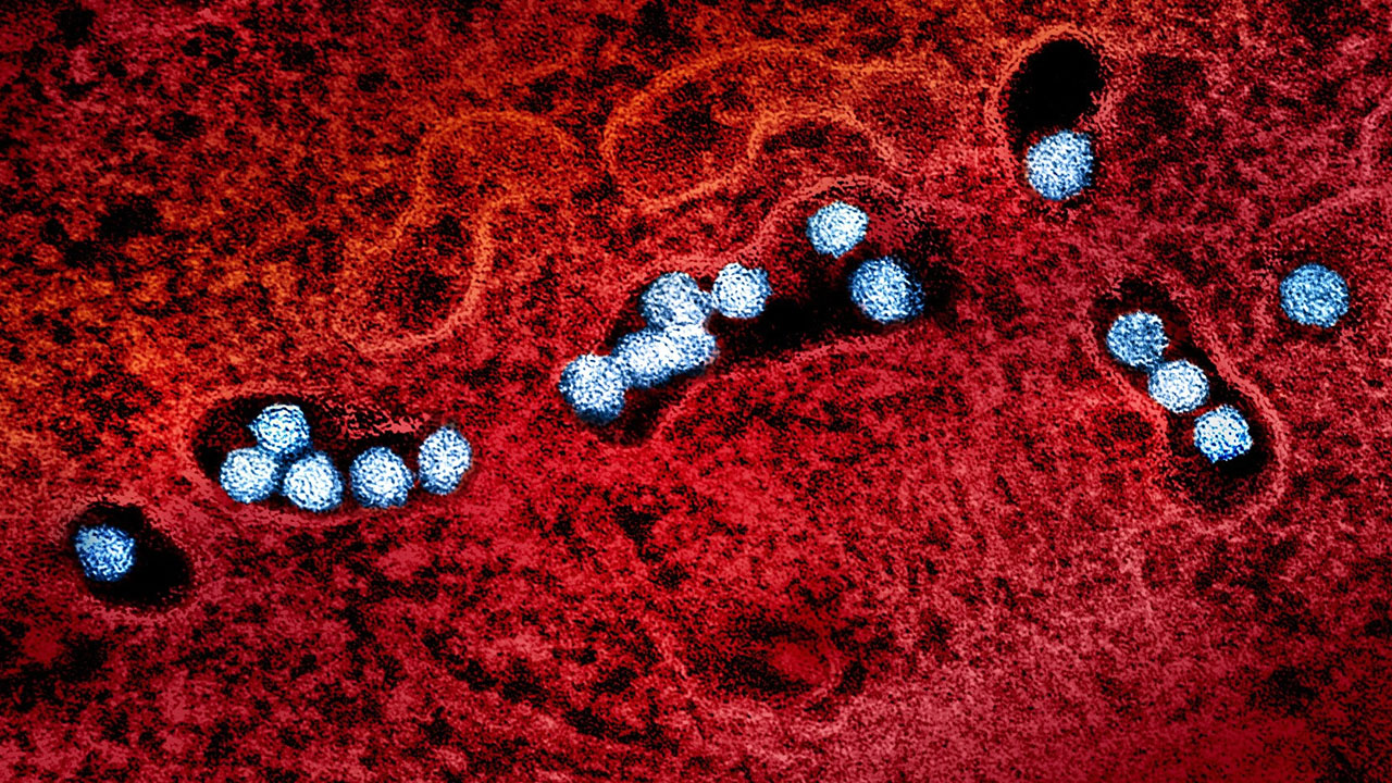 Mysterious virus with no known treatment spreads quickly along the West ...