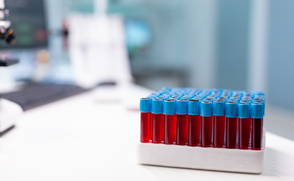 American Heart Association's new cholesterol guidelines emphasise ...