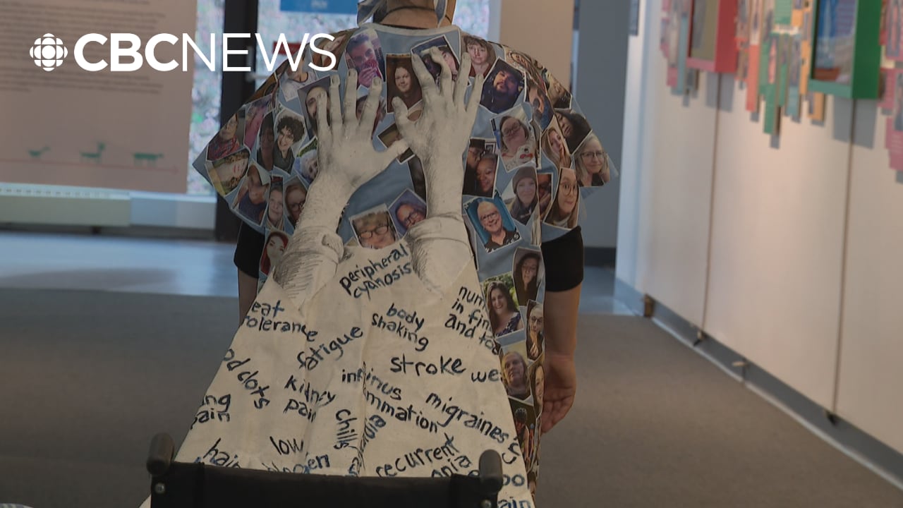 Doctors, patients raise awareness on Long COVID Awareness Day