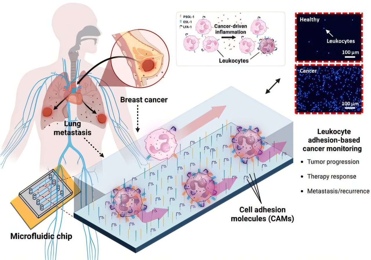 Microfluidic chip tracks cancer relapse by measuring white blood cell ...