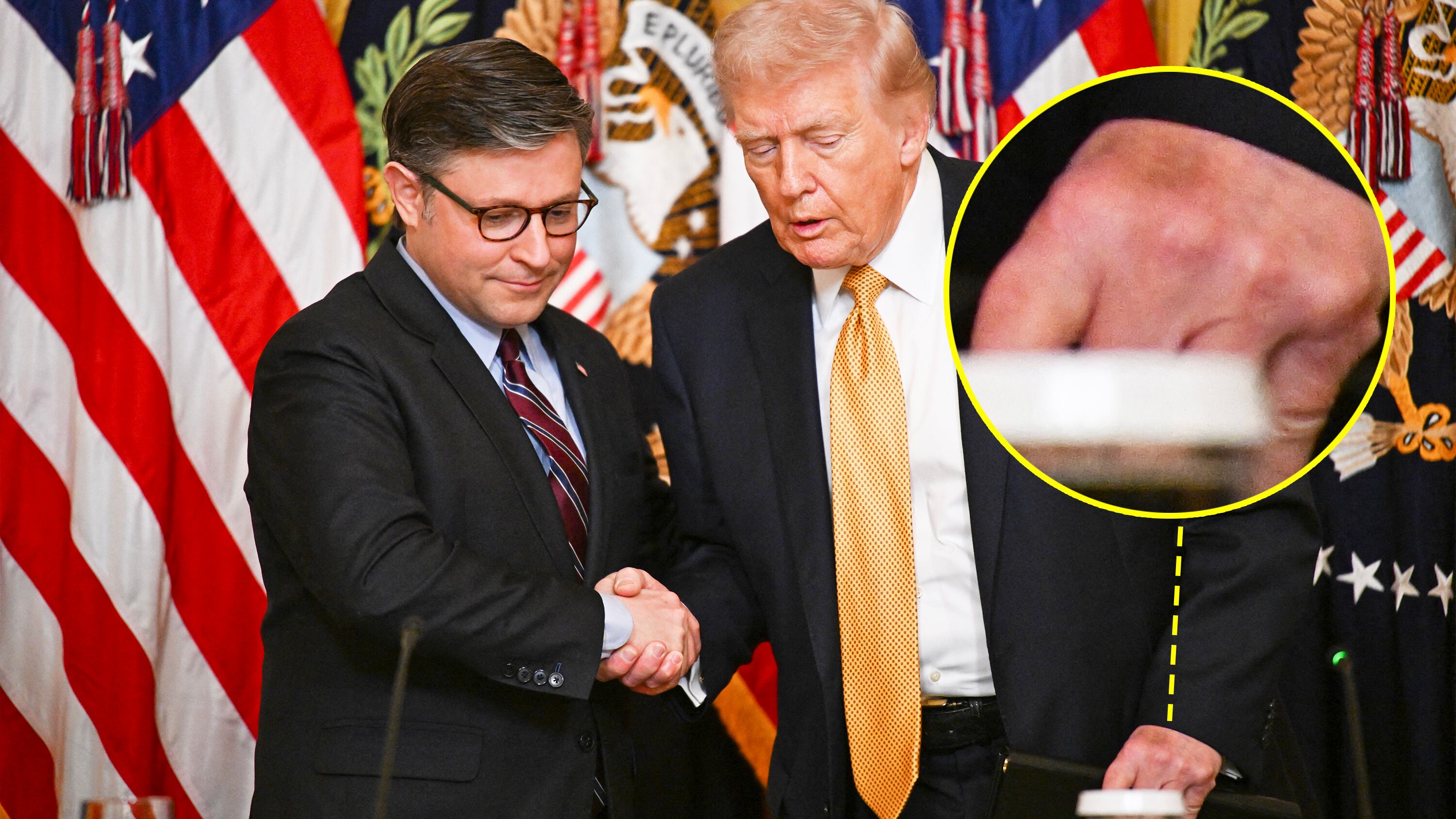 Comedians roast Trump’s delusional belief that he’s healthy