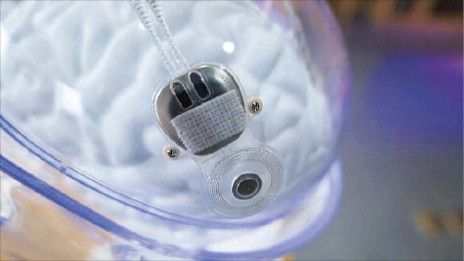 China approves first invasive BCI device