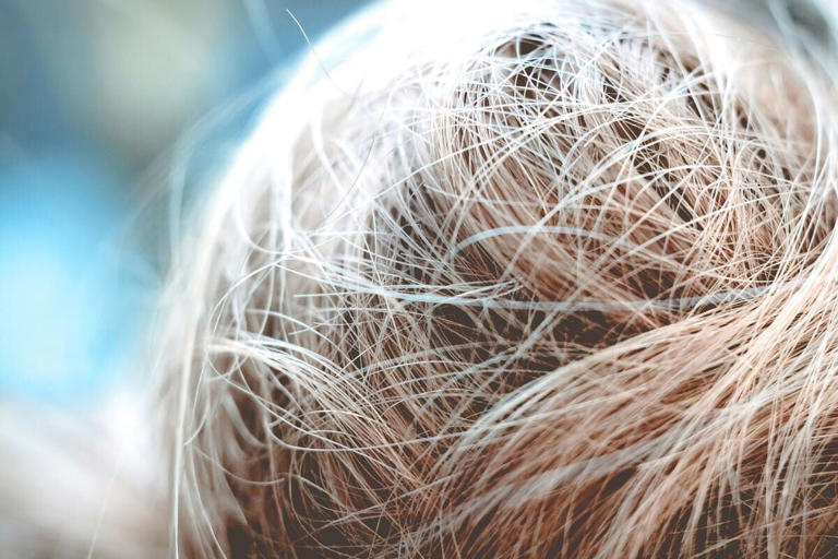 ¿Se pueden revertir las canas? Esto dice la ciencia