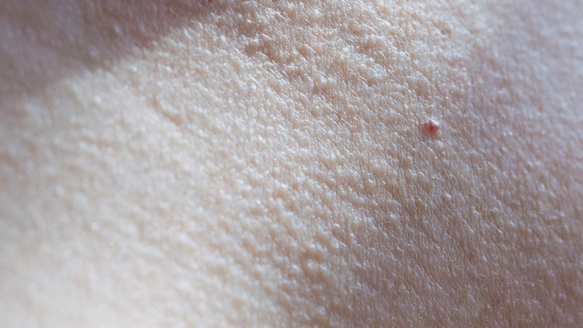 10 signs your skin is overhydrated & 10 signs it needs more moisture