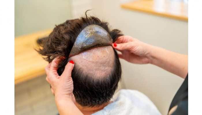 Common myths about hair patches and what people should know