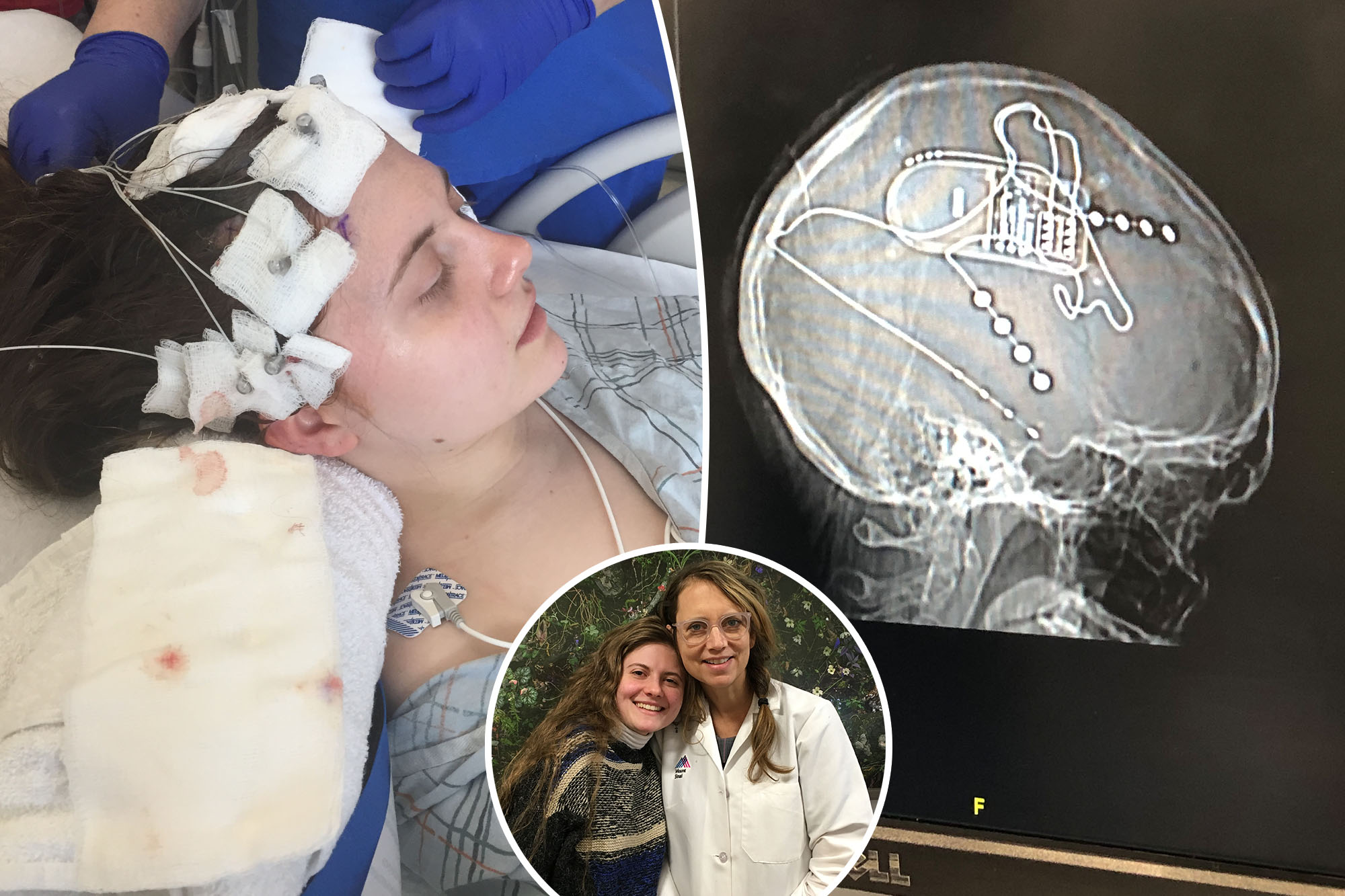 My 'panic attacks' turned out to be much more serious — I needed brain ...