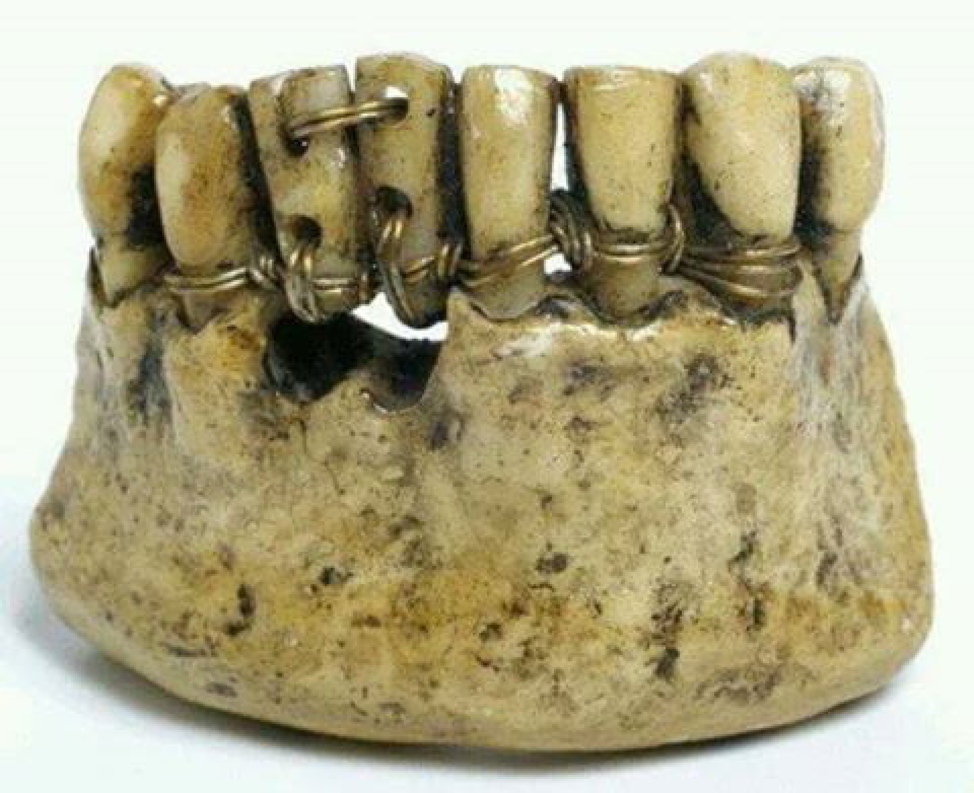 Why our ancestors didn’t care about straight teeth