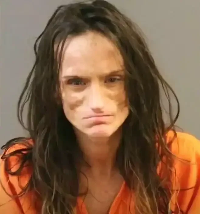 La chocante evolución de Misty Loman luchando contra lupus, cáncer óseo ...