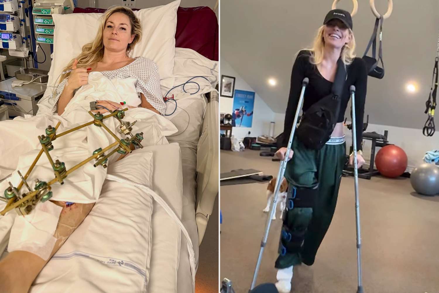 Lindsey Vonn reveals her sister also tore her ACL: 'Welcome to the Vonn ...