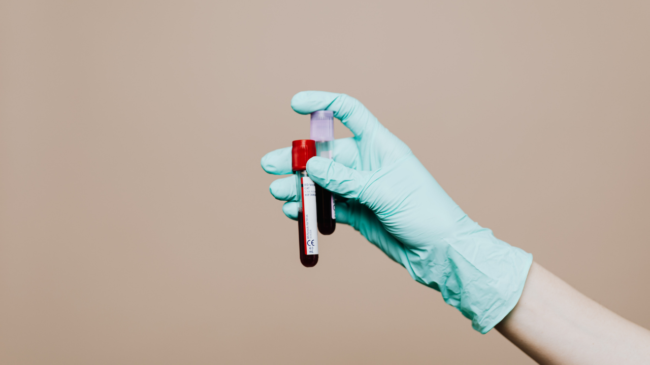 Your blood test may look normal, but these hidden markers can reveal ...