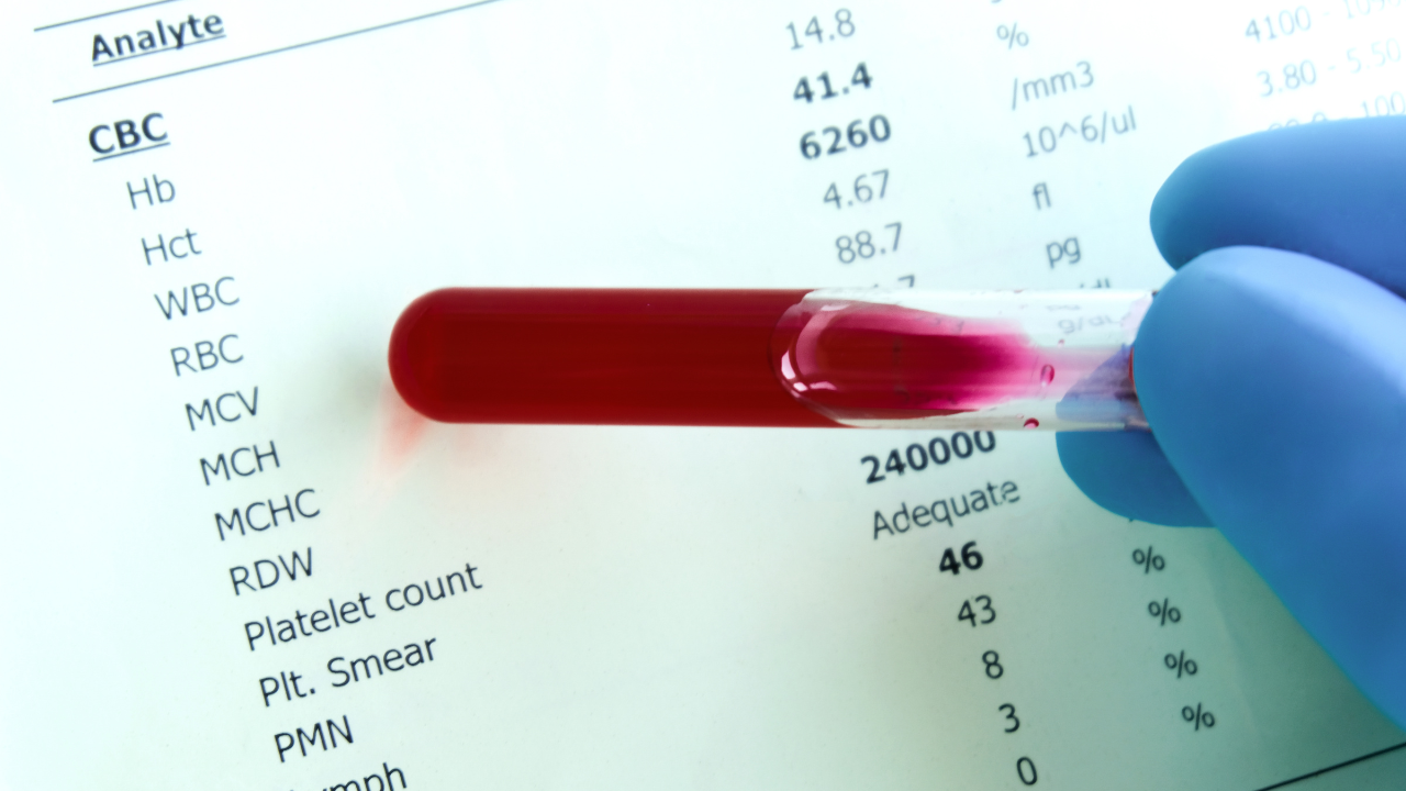 Your blood test may look normal, but these hidden markers can reveal ...