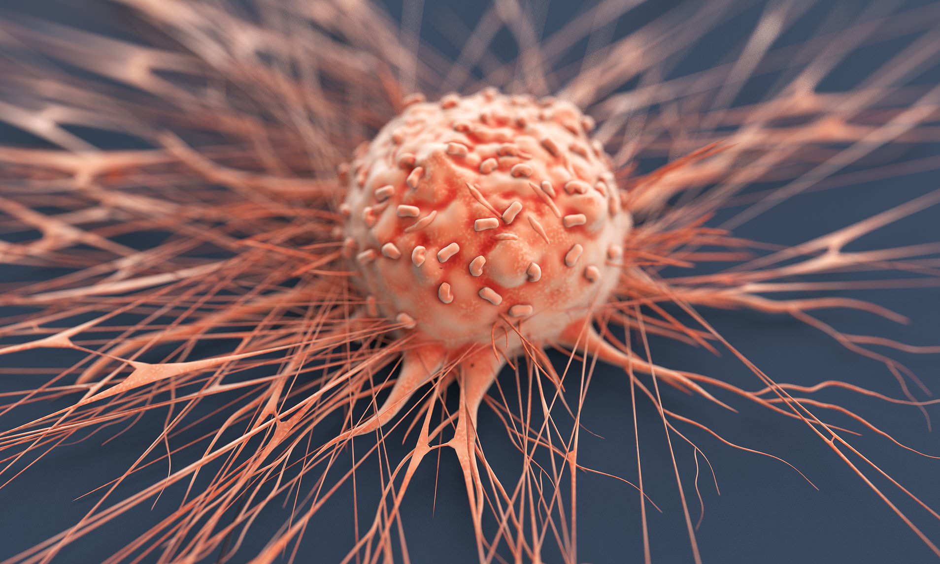 Alarming rise in three deadly cancers worries experts - as rates for ...