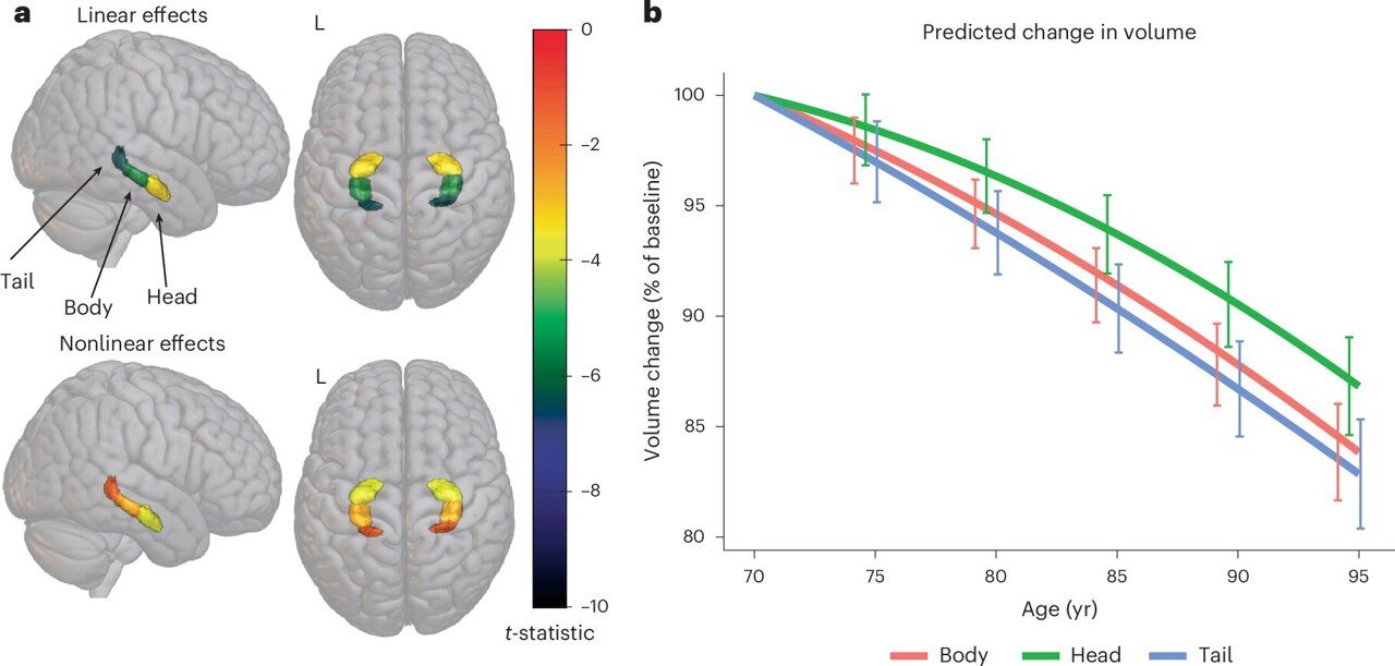 Why street layouts may matter for aging brains: Brain scans link ...
