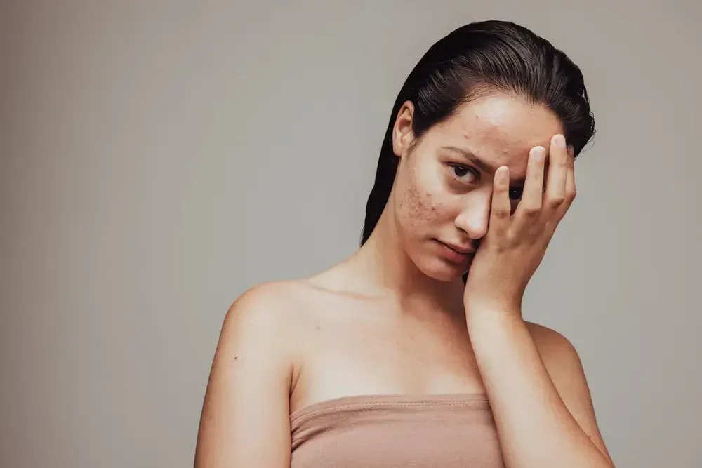 Stressed? This is the sign that appears on your face, and it can be ...