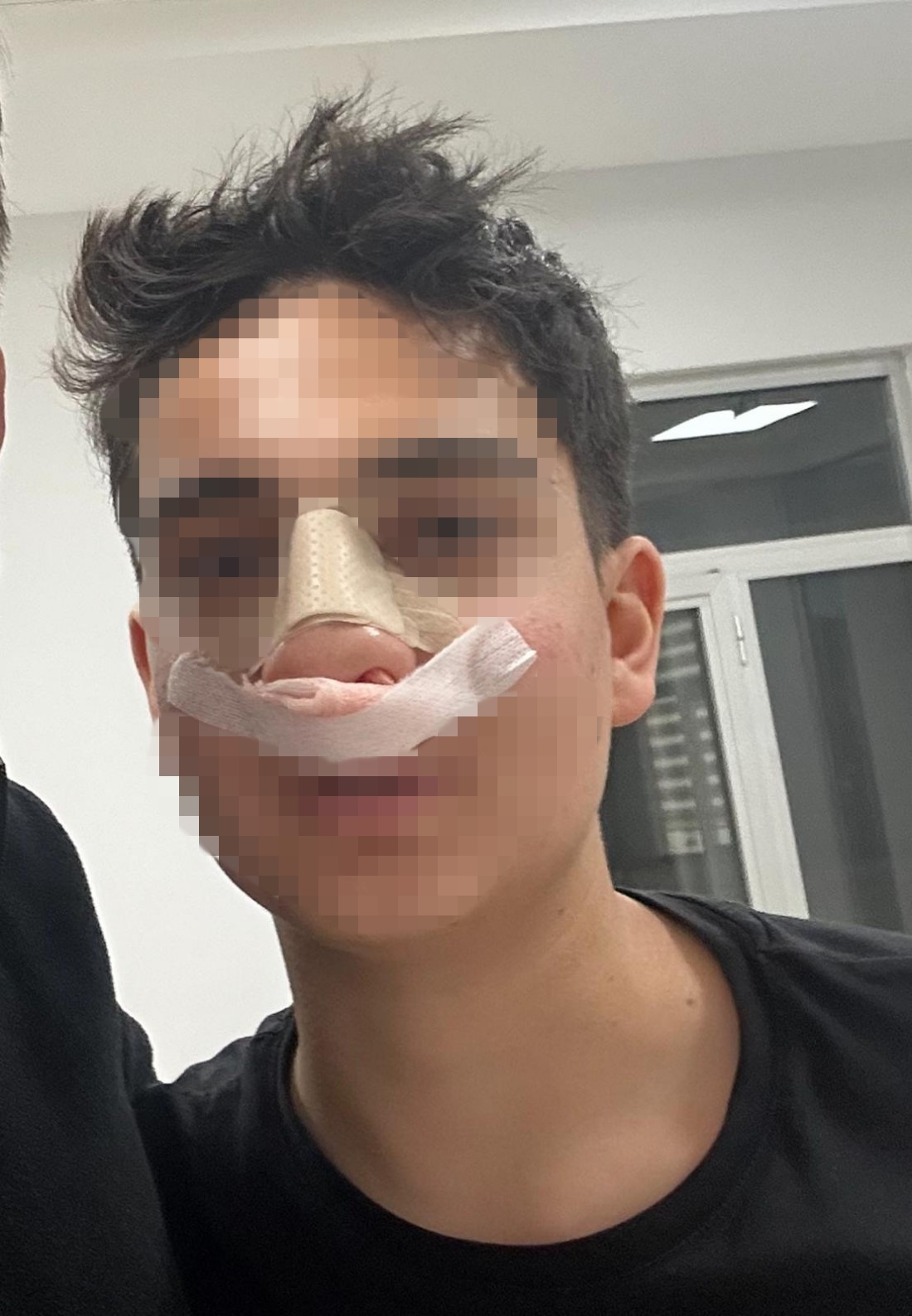 Hiç tanımadıkları genci "Neden bakıyorsun" diye darp edip burnunu kırdılar