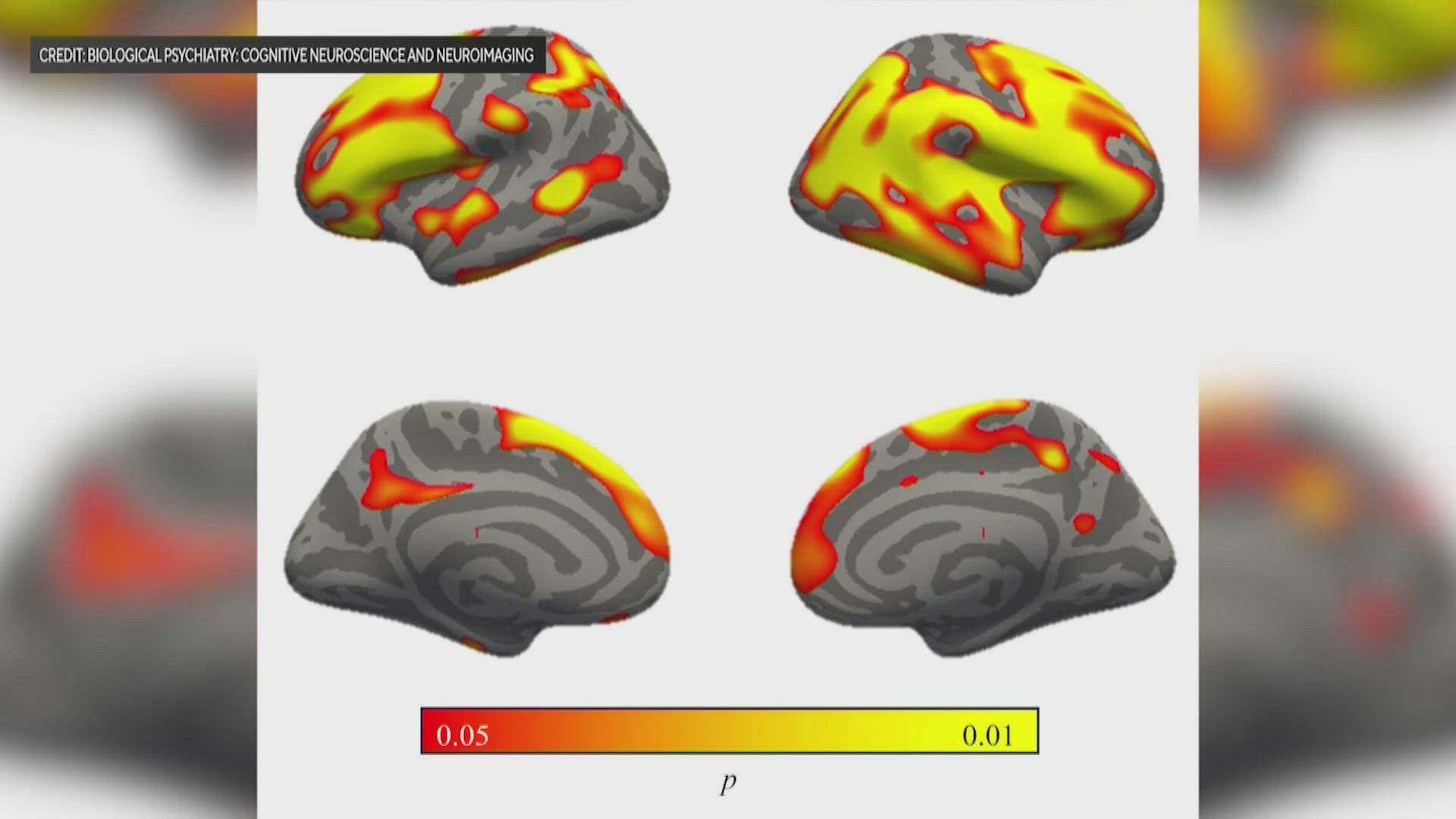 New PTSD research may change how it is understood and diagnosed