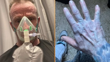 Man rushed to hospital after turning blue discovers cause was new bed ...
