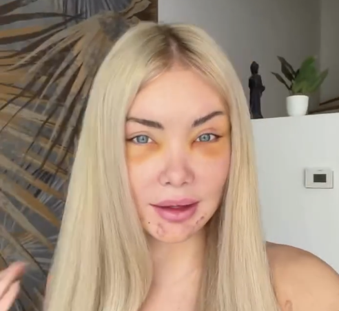 Sabrina Wlk will ihr altes Gesicht zurück