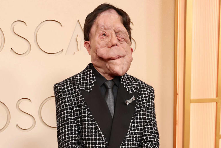 Adam Pearson claps back at comedian who made fun of his appearance: ‘I ...