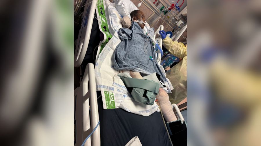 Woman dies after brutal dog attack in Mississippi