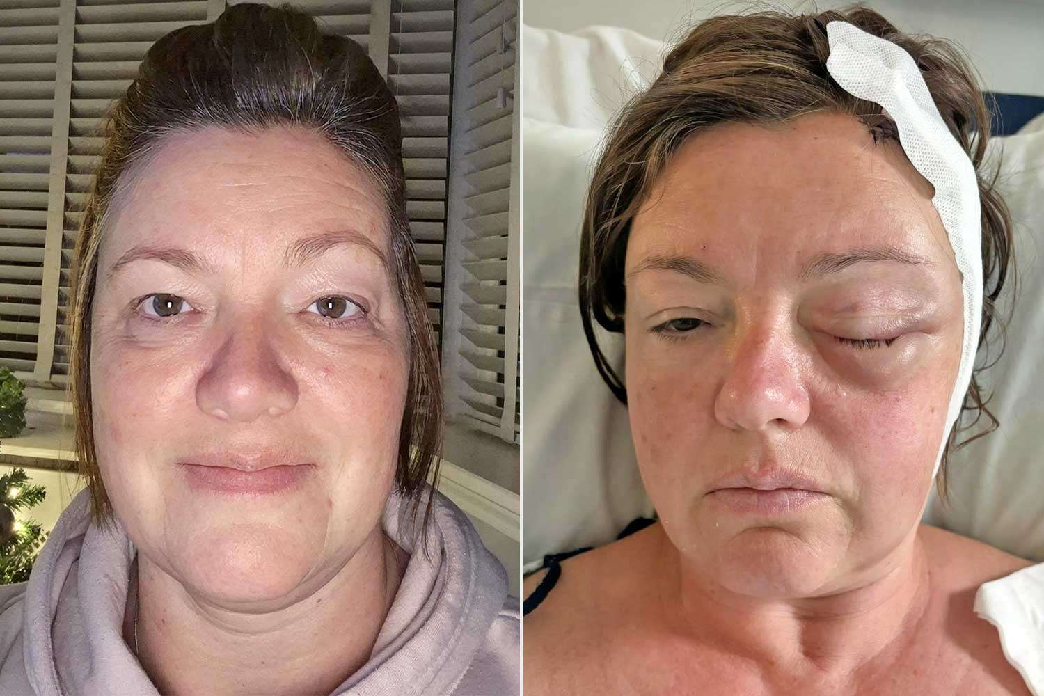 Woman, 47, was applying mascara when she noticed her vision was off ...
