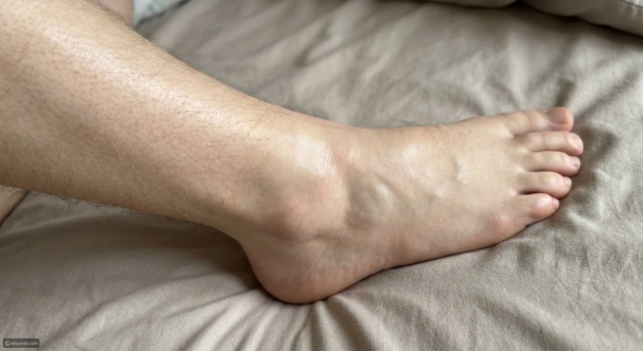 Foot symptoms that may indicate heart problems