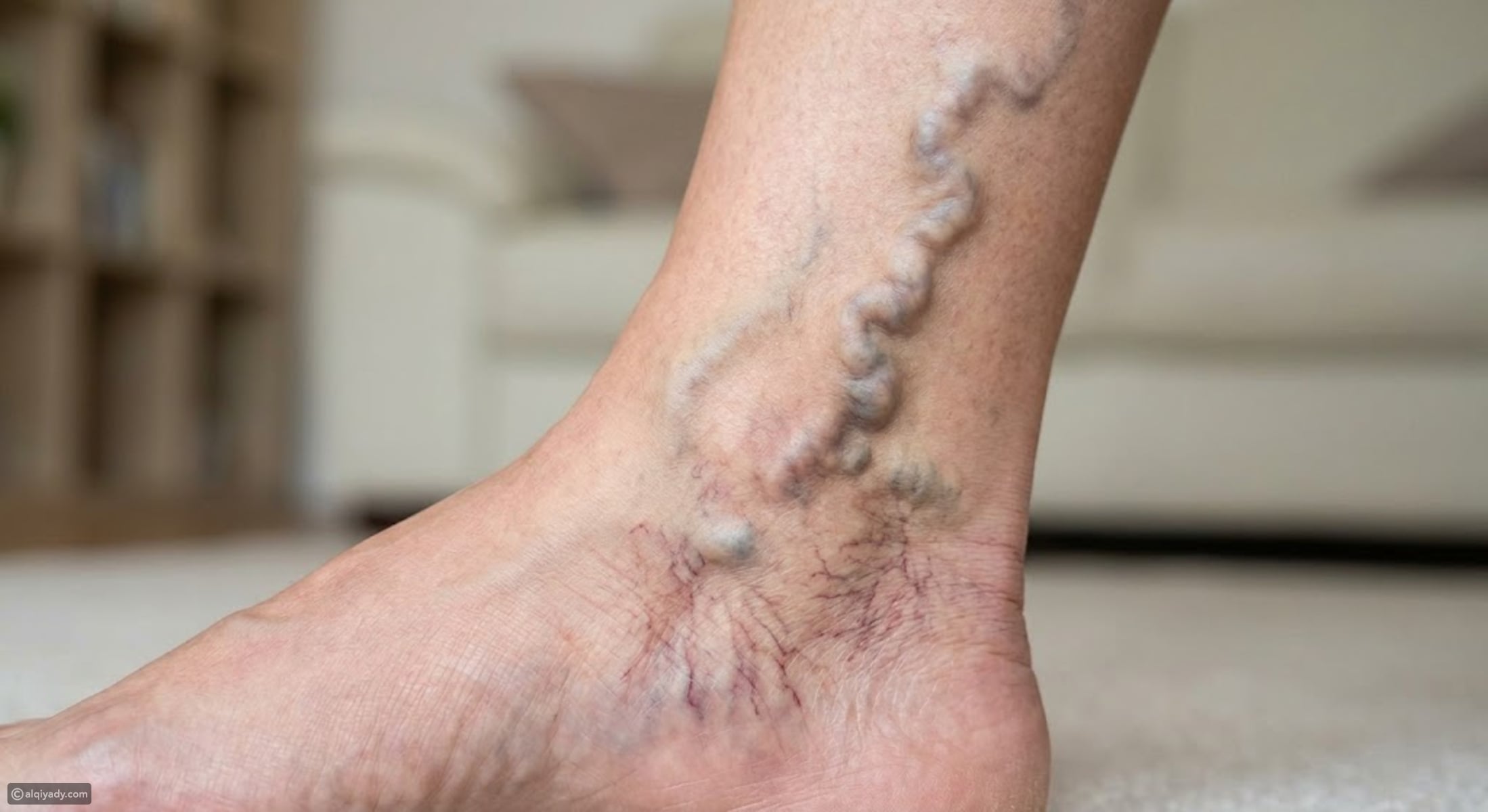 Foot symptoms that may indicate heart problems