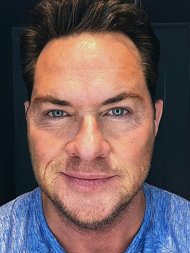 Real Housewives star's fiancé shocks fans with dramatic plastic surgery ...
