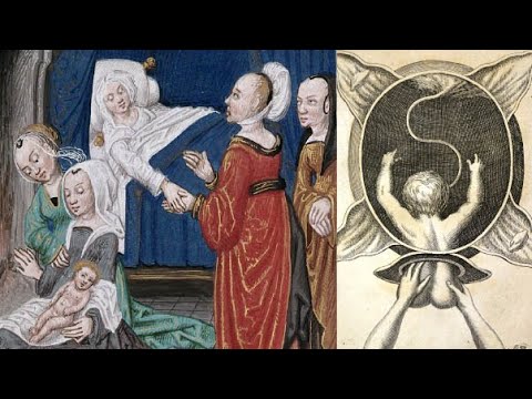 A history of childbirth: delivery