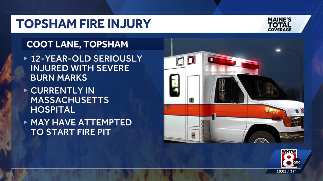 Maine boy severely burned in Topsham fire