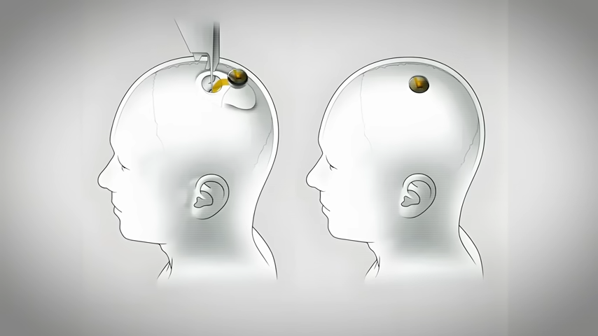 Why are data rates crucial for brain-machine communication?