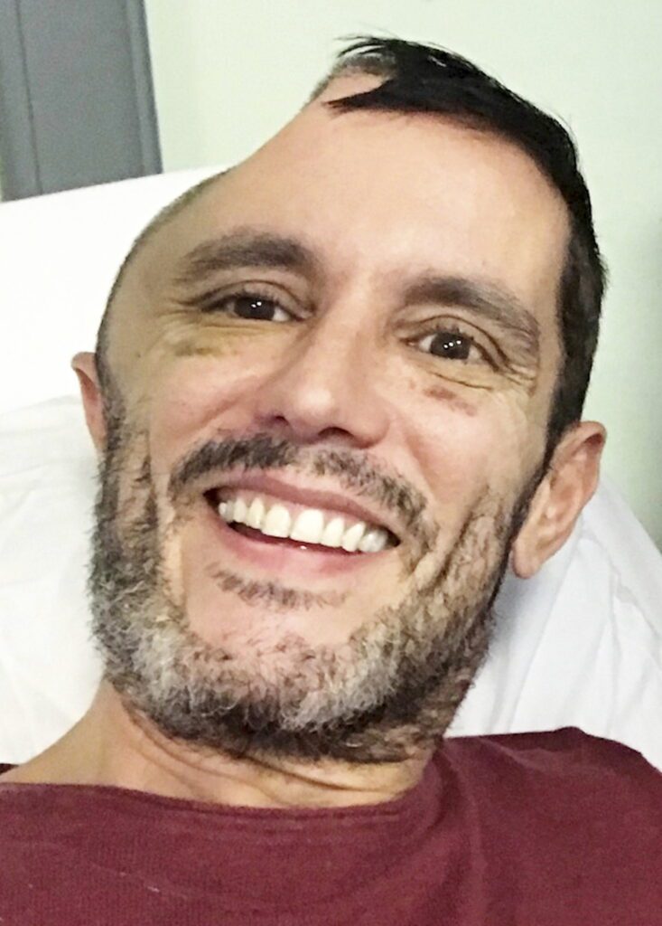 Man loses 'half his head' after slip and fall at Tube station