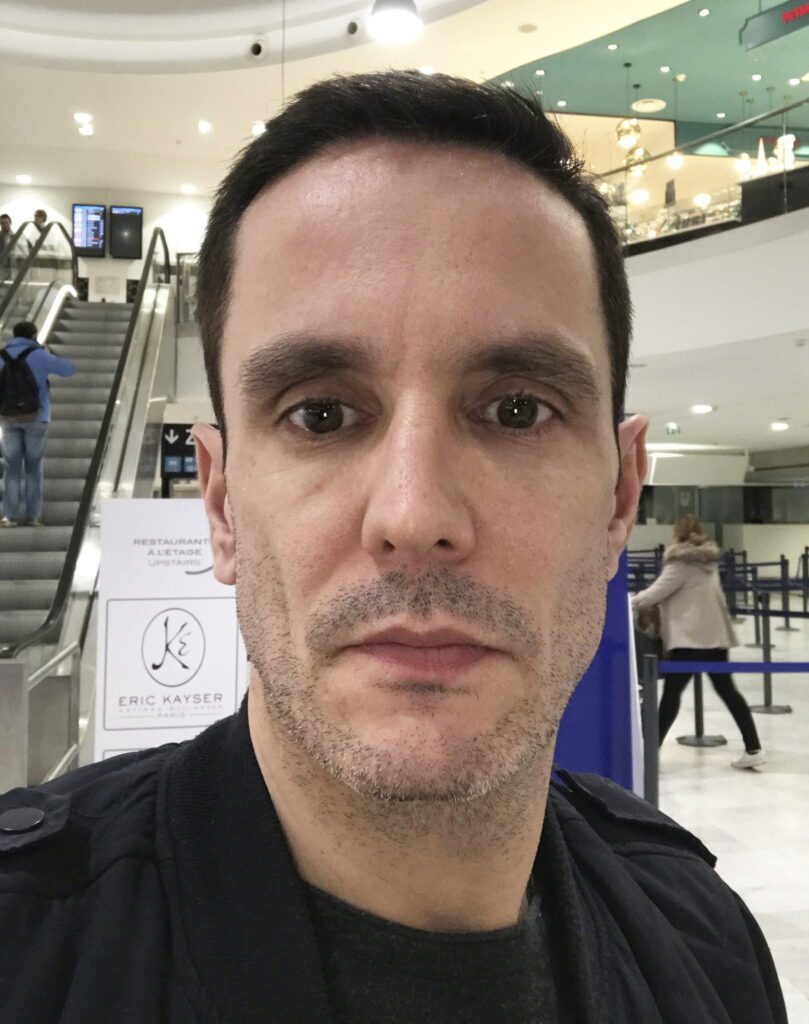 Man loses 'half his head' after slip and fall at Tube station