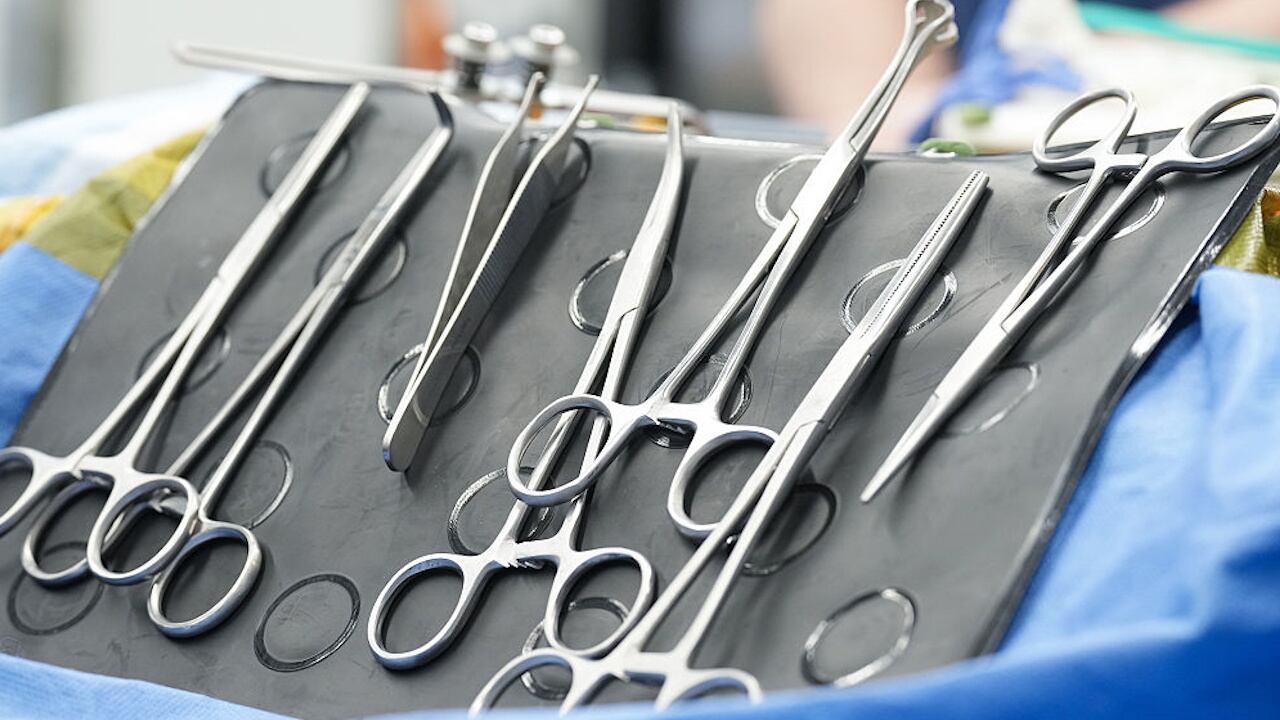 ‘It had horns’: Woman has ‘monster’ kidney stone removed