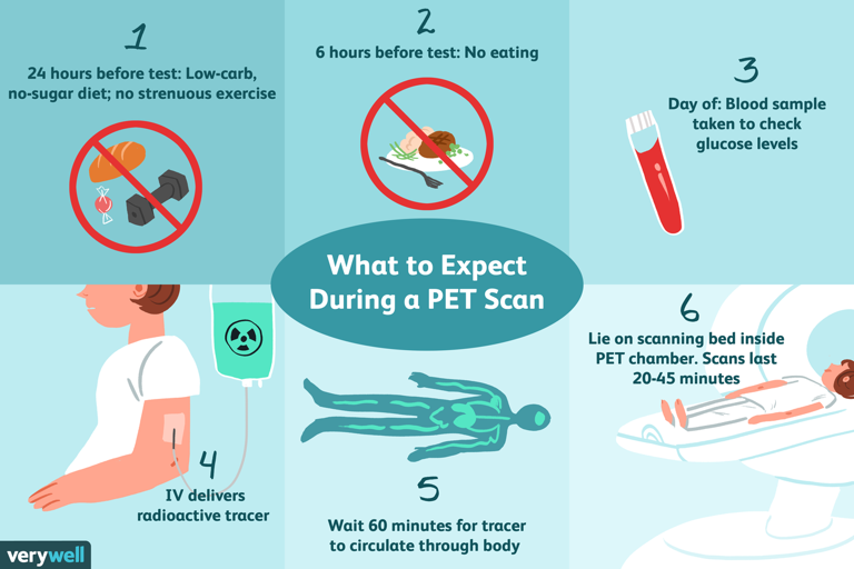 What is a PET scan?
