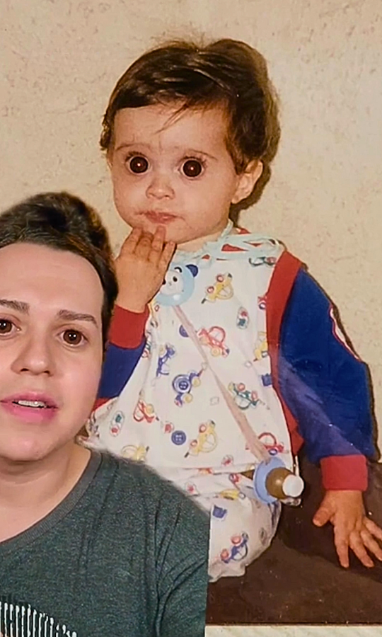 I was born with huge eyes