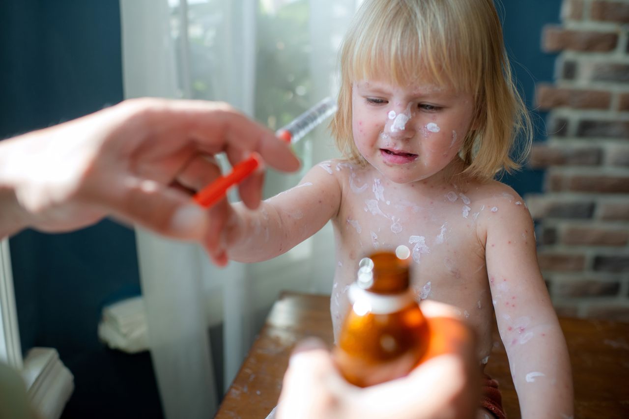 Can rash be a symptom of RSV?