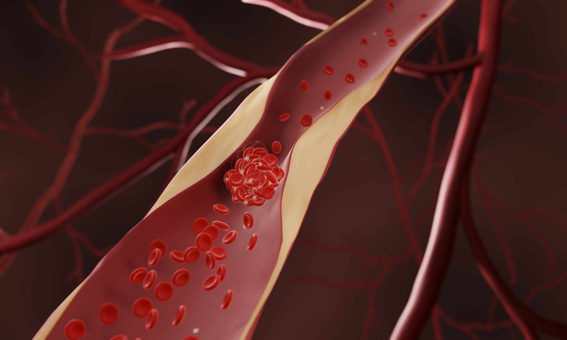 If you have high cholesterol, there are alternatives to statins