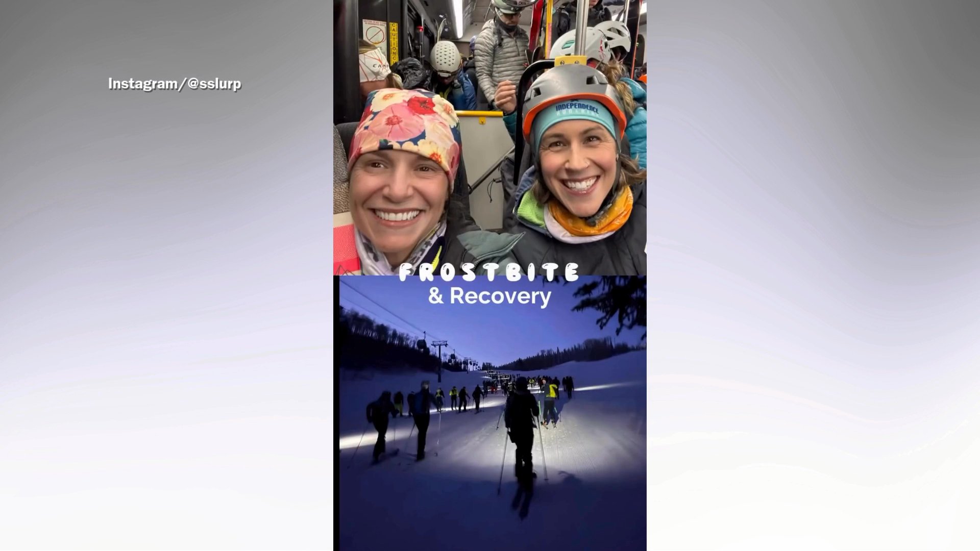 Woman documents recovery after developing frostbite in hands