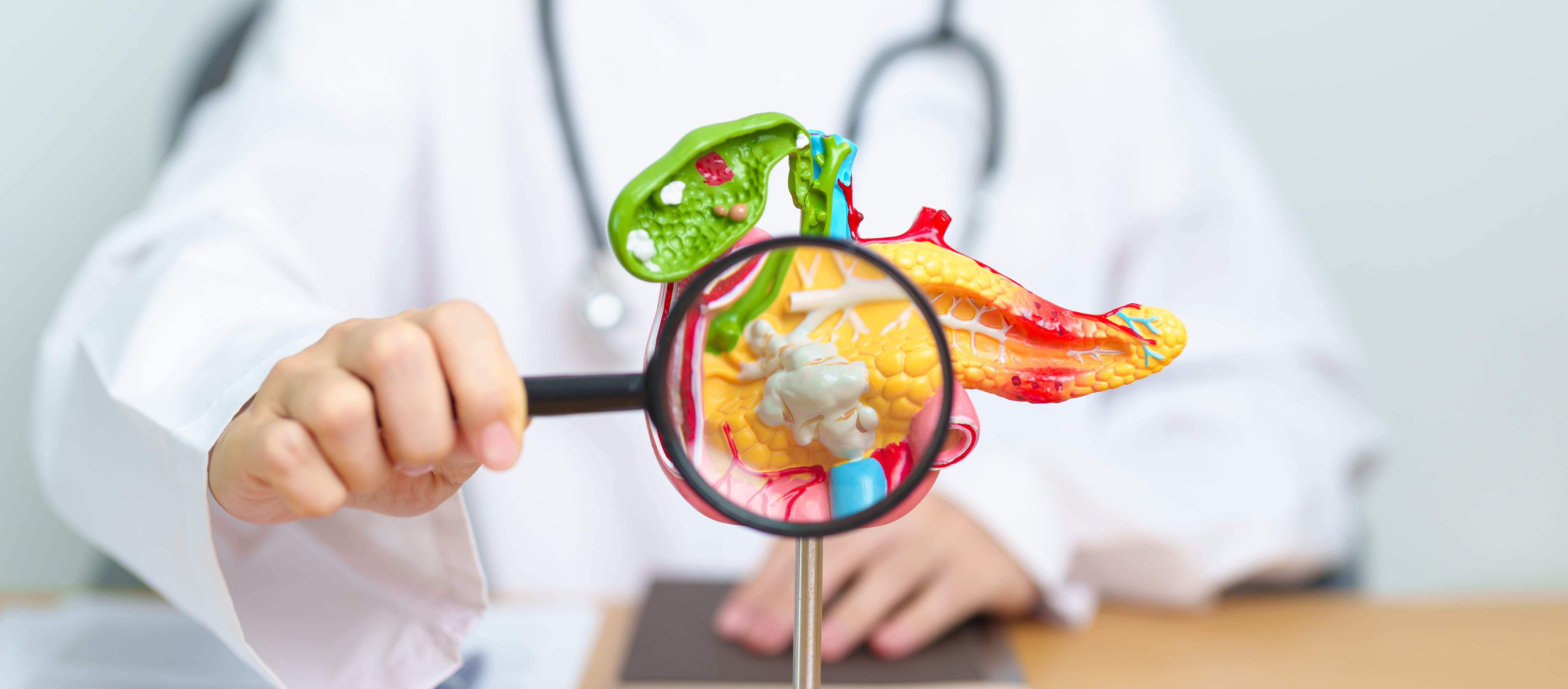 Este cáncer no presenta síntomas hasta etapas avanzadas: lo que debes saber