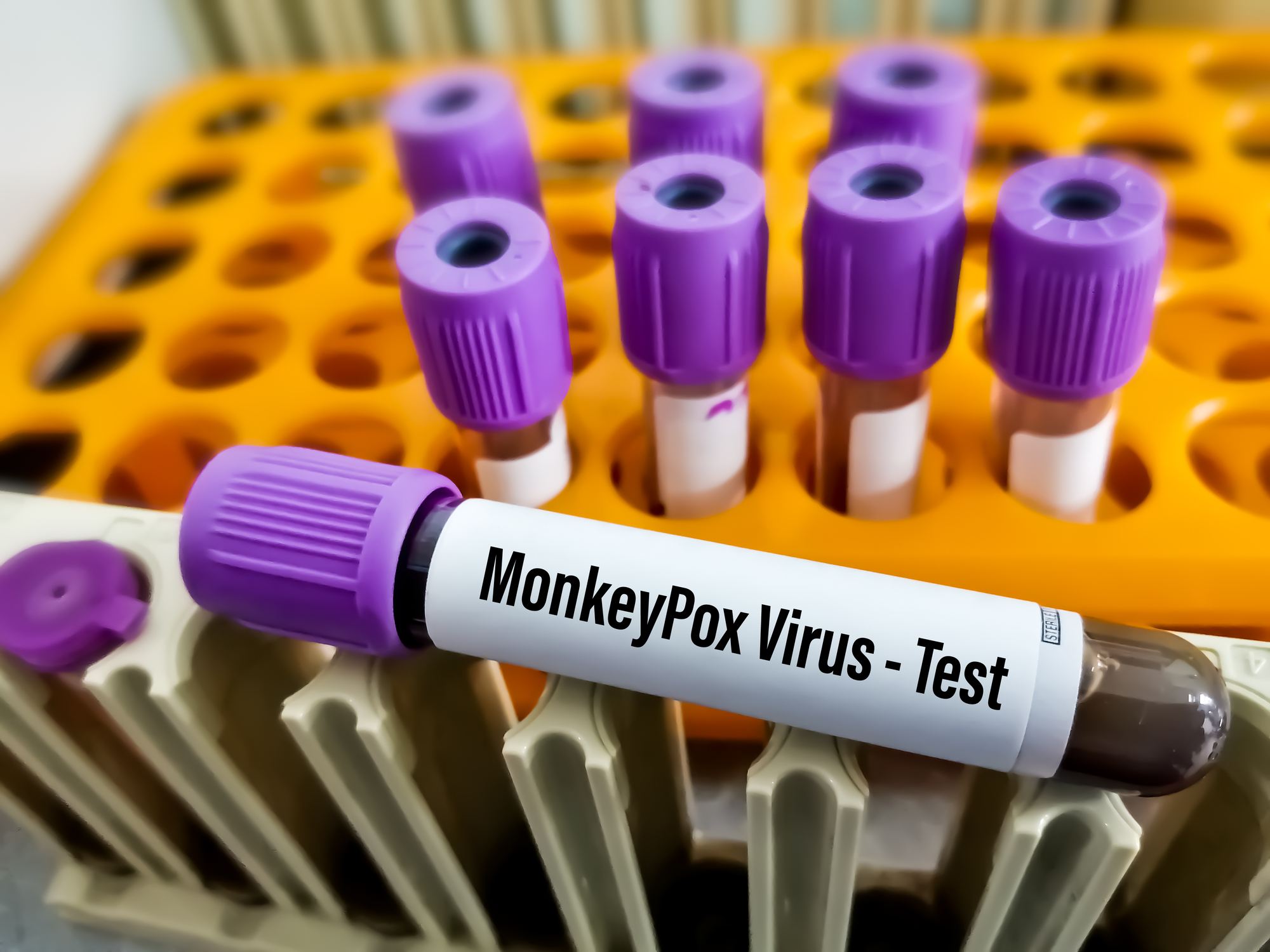 CDC temporarily stops rabies, pox virus testing
