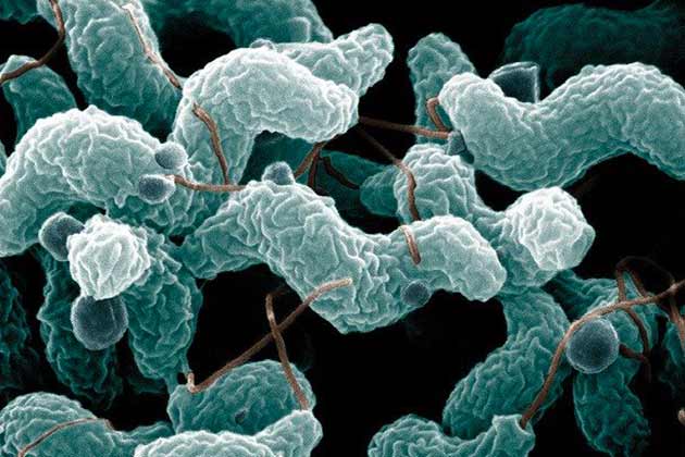 There are 9 types of food poisoning—here's how to protect yourself